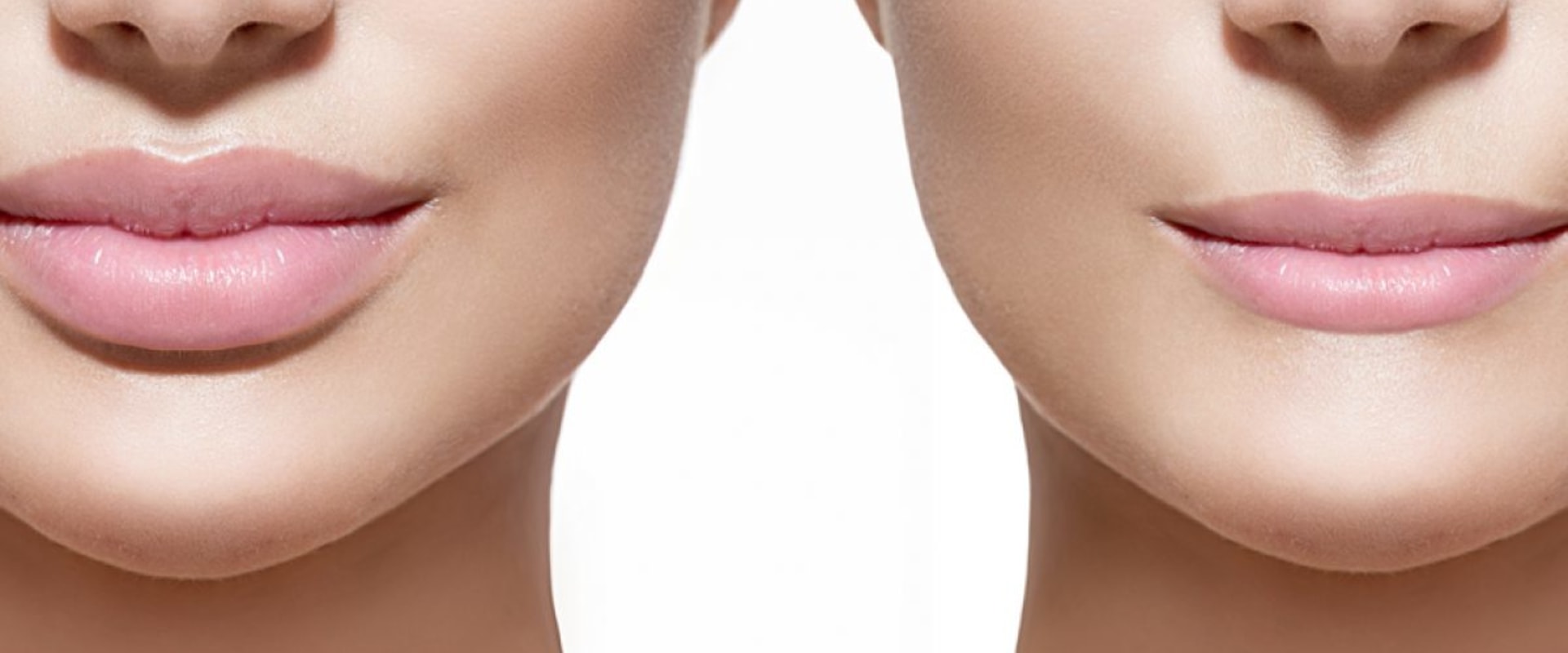 The Benefits of Restylane Injections: A Comprehensive Guide